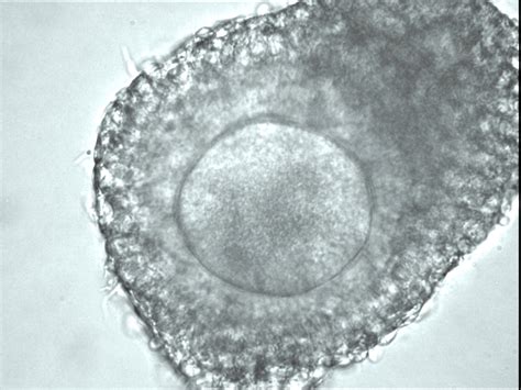 A Cumulus Enclosed Oocytes Eshre