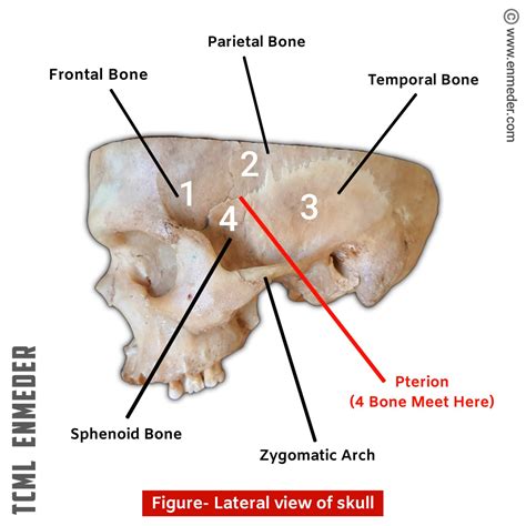 Pterion Tcml The Charsi Of Medical Literature
