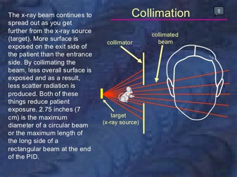 What Is Beam Collimation In Ct Scan At Eloise Rameriz Blog
