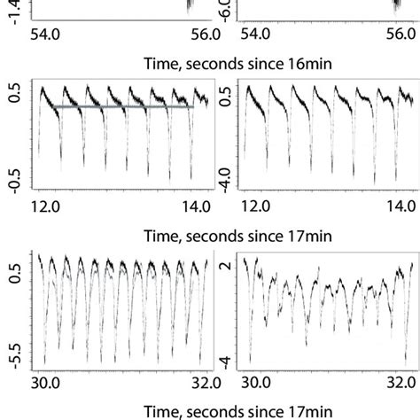 A Cosine Series Signal Accurately Represents Mean Mea Voltage In Some