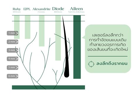 เลเซอร์กำจัดขน แบบสุดปัง Aileen ผิวใส ไรขน กวนใจ ทำได้ทุกจุด