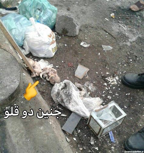 عکس جنین سقط شده سه ماهه پسر