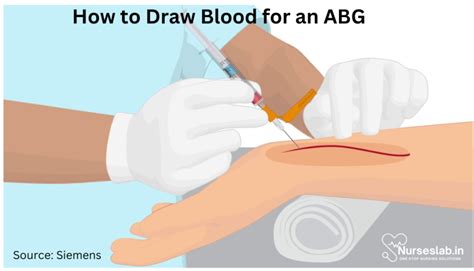 Abg Interpretation For Nurses Nurseslab