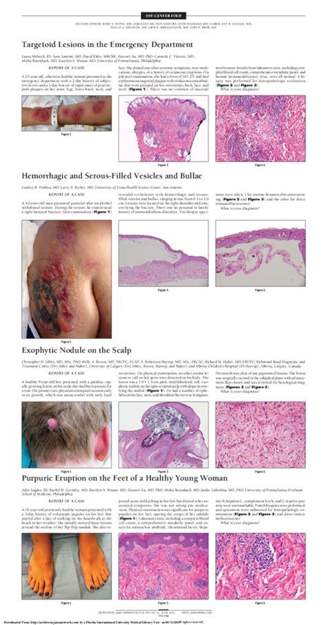 Pdf Exophytic Scalp Nodule Case Studies Review