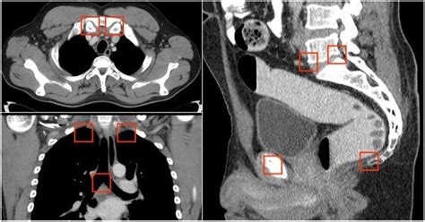 Application Of Object Recognition In Anatomical Landmarks Detection Download Scientific Diagram