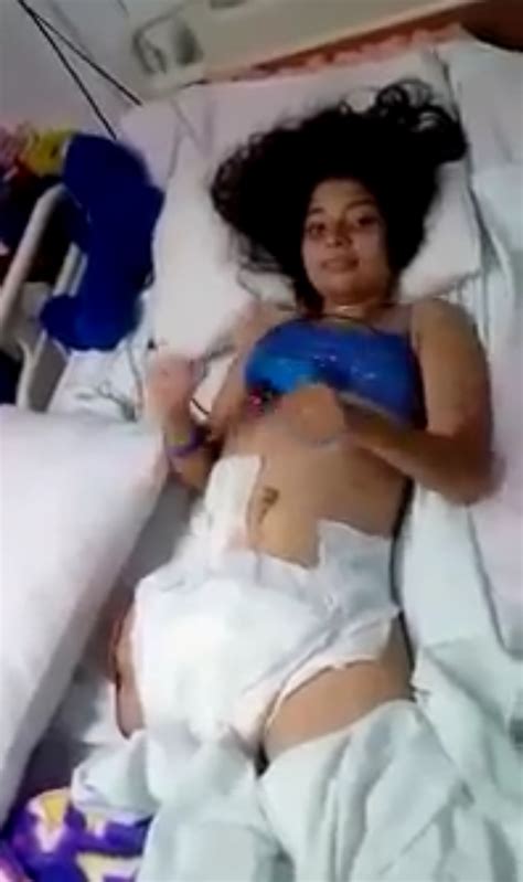 Hip Amputee Video 17