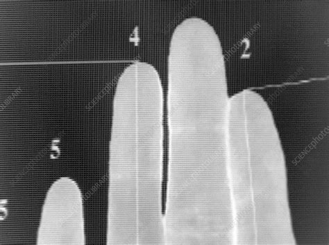 Ring Finger And Sexual Attraction Stock Image C001 7125 Science Photo Library