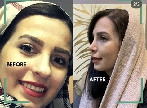 دکتر الهام ایمانی متخصص گوش حلق و بینی در مشهد هزینه عمل مشهد پزشک