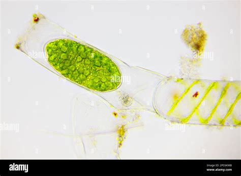 Microscopic View Of Freshwater Green Algae Spirogyra Filament With
