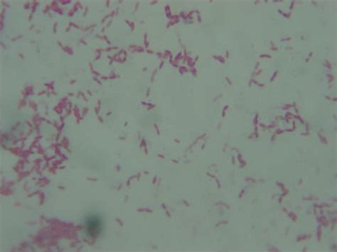 Agrosavia Corporación Colombiana De Investigación Agropecuaria