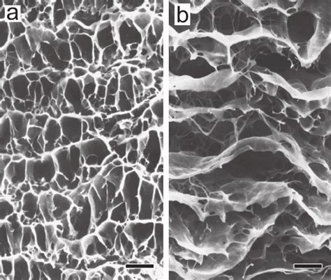 Three Dimensional Architecture Of Elastic Fibers In The Human Aortic