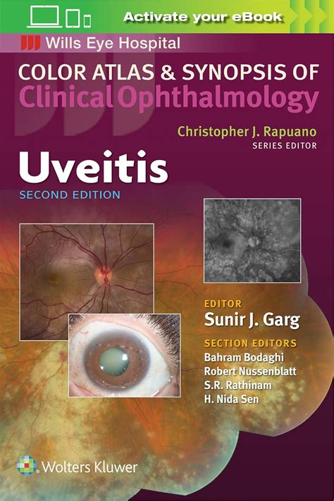 Uveitis Color Atlas And Synopsis Of Clinical Ophthalmology