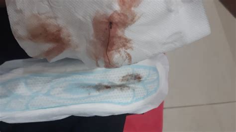 Corrimento Rosa É Sinal De Gravidez Gravidezimg