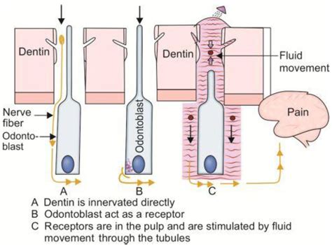 Dentin Sensitivity Theories Focus Dentistry