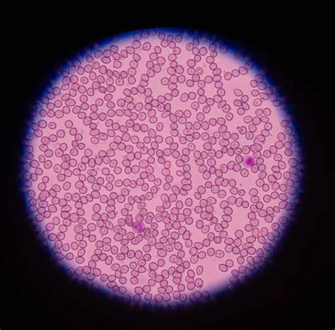 Imágenes De Células Sanguíneas Del Microscopio Eritrocitos