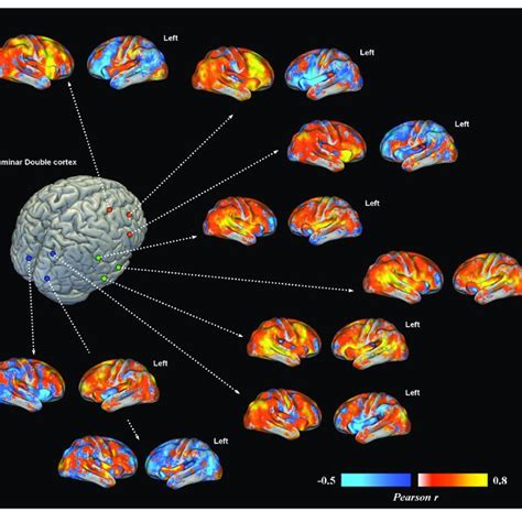 A Localization And Extension Of Double Cortex Dc Like Download Scientific Diagram