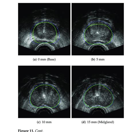 Superpixel Regions After Graph Cut Procedure The Centroids Of Regions