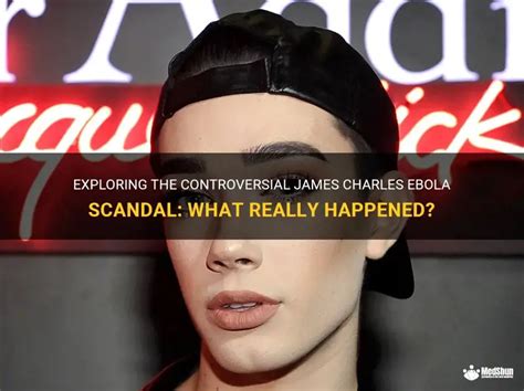 Exploring The Controversial James Charles Ebola Scandal What Really Happened Medshun