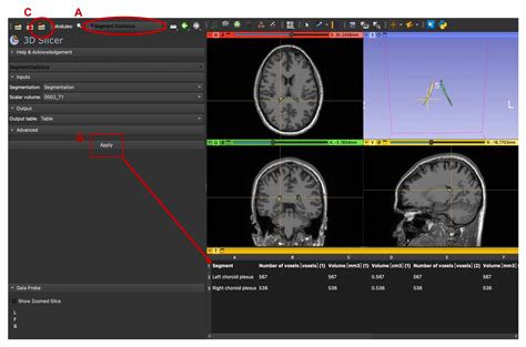 Video Author Spotlight Bridging Gaps In Anatomy And Establishing A