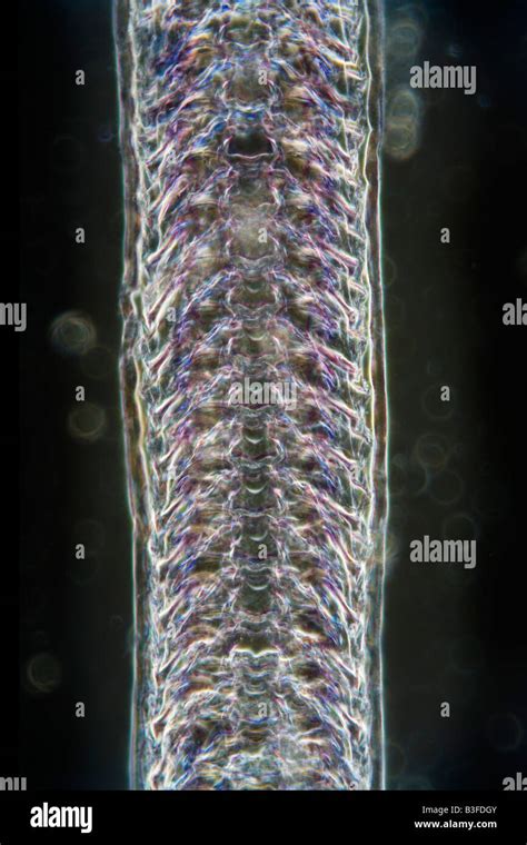 Snail Radula Darkfield Photomicrograph Showing Rasping Surface Stock