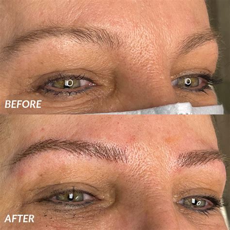 Full Nano Brows Before And After Advanced Esthetics Lvc