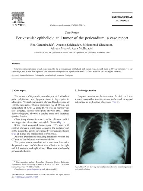Pdf Perivascular Epithelioid Cell Tumor Of The Pericardium A Case Report