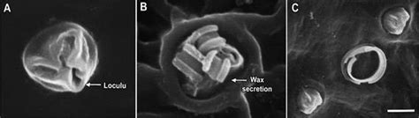 Ultrastructural Morphology Of The Trilocular Pores Of Pseudococcus
