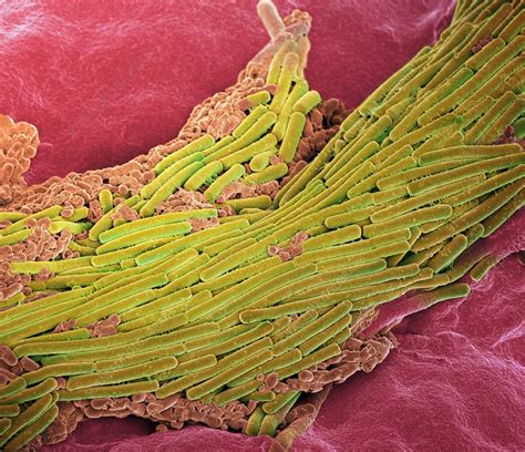 Clostridioides Difficile Bacteria Sem Stock Image C007 1175 Science Photo Library