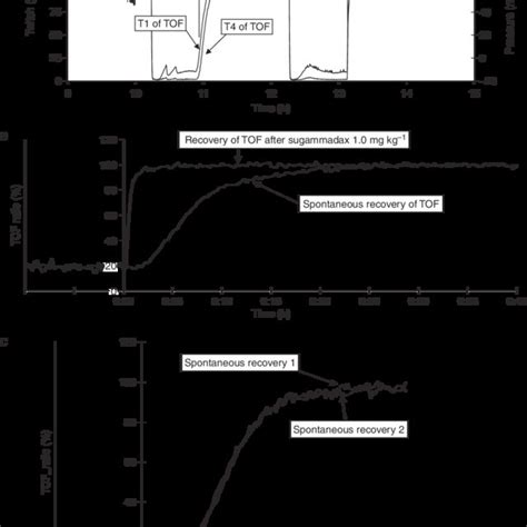 Recovery As Measured By The Tof Ratio Of Neuromuscular Block By Download Scientific Diagram