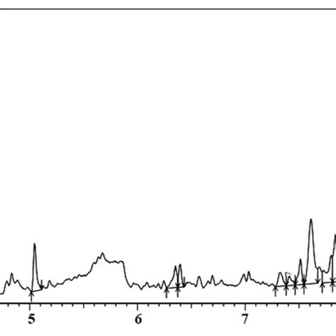 Gcms Chromatogram Showing Chemical Constituents Of N Hexane Extract Of Download Scientific