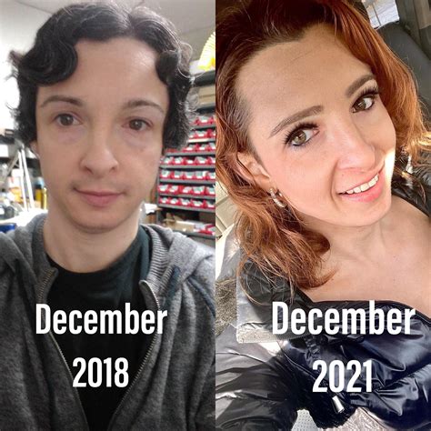 117 Best Postop Gcs Images On Pholder Trans Later Transpositive And Lgbt