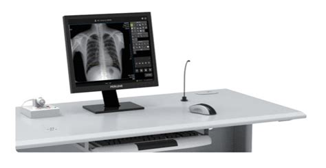 All In One Dynamic Flat Panel Detector Radiography And Fluoroscopy System PerLove