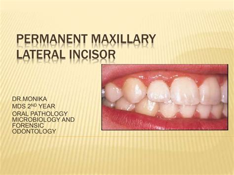 Mandibular Central Incisor Pptx
