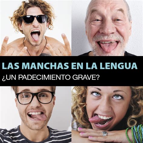 Manchas En La Lengua Rojas Blancas Negras Cáncer Y Porqué Salen