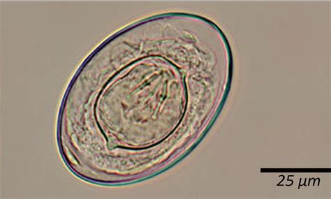 Hymenolepis Nana Egg Parasitology