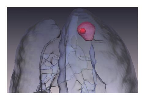 3d Visualization Of Patient Cases With Spatial Mismatch And Match Download Scientific Diagram