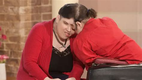 Worlds Oldest Conjoined Twins Lori And George Schappell Die At 62