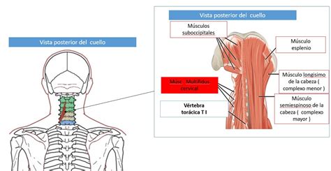 Multifidus Cervical