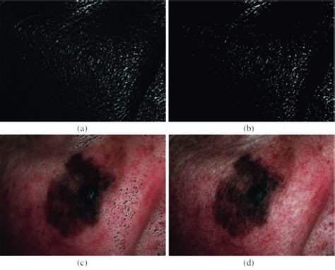 Specular Reflection Removal In Skin Image Taking The Mm In Figure 1 Download Scientific