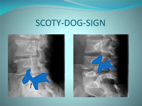 Ppt Signs In Radiology Powerpoint Presentation Id510632