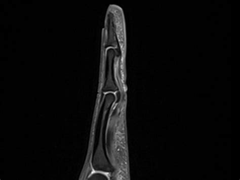 sagittal pd tse fs magnetom vida siemens healthineers usa