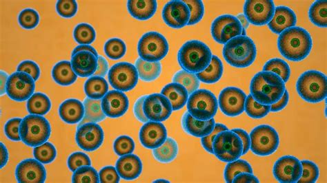 Brain Cancer Battle One Woman S Brain Cap Treatment Story NJ