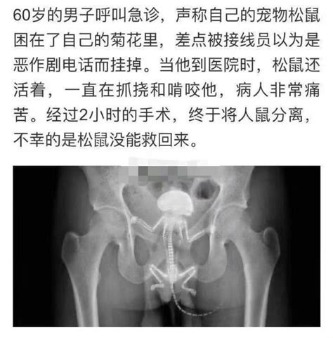 啊？？？？？ 涨姿势