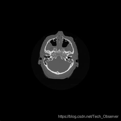 什么是体数据可视化volume Data Visualization Csdn博客