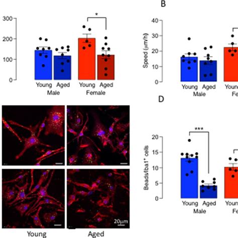 Age Affects Microglial Motility In A Sex Dependent Manner Microglia