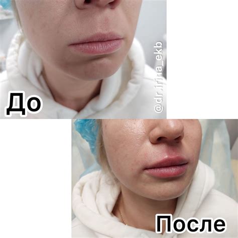 Врач Косметолог Врач Косметолог Екатеринбург