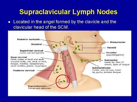 Supraclavicular Lymph Nodes Anatomy Diagram Function Body Maps My Xxx