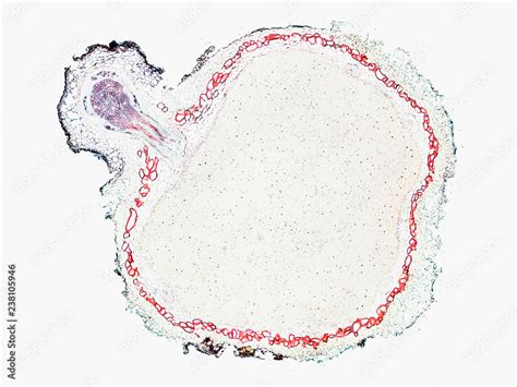 Rhizobium Soybean Root With Unattached Nodule Cross Section Cut Under The Microscope
