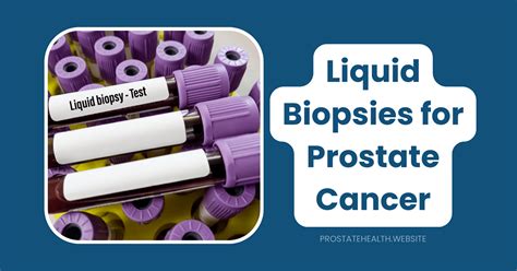 Prostate False Results When Tests Get It Wrong 2025