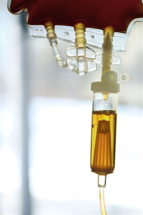 Services Intravenous Iron Infusions Tayside Complete Health